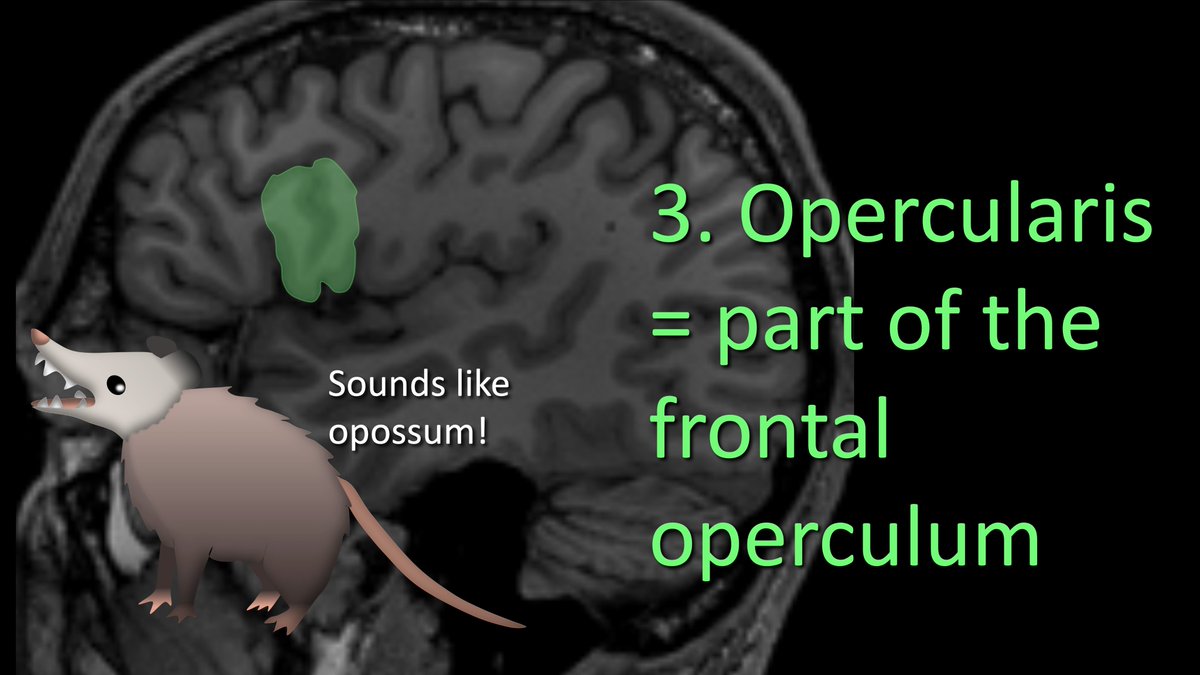 1/Do you get a Broca’s aphasia trying remember the location of Broca's ...