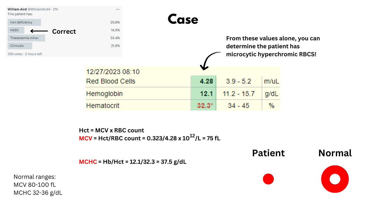1/3 MICROCYTIC HYPERCHROMIC RBCs I tweeted a poll yesterday asking to ...
