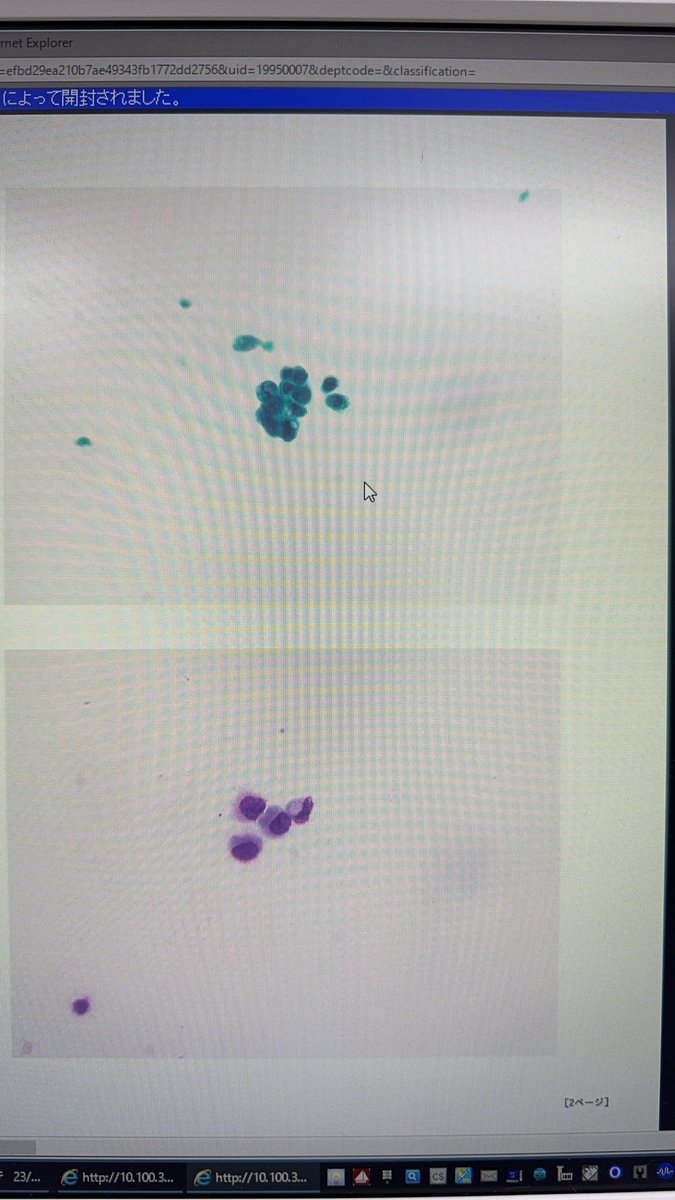 高岡さんがフジ韓流ゴリ押し批判したら干されたのでウジテレビ凸