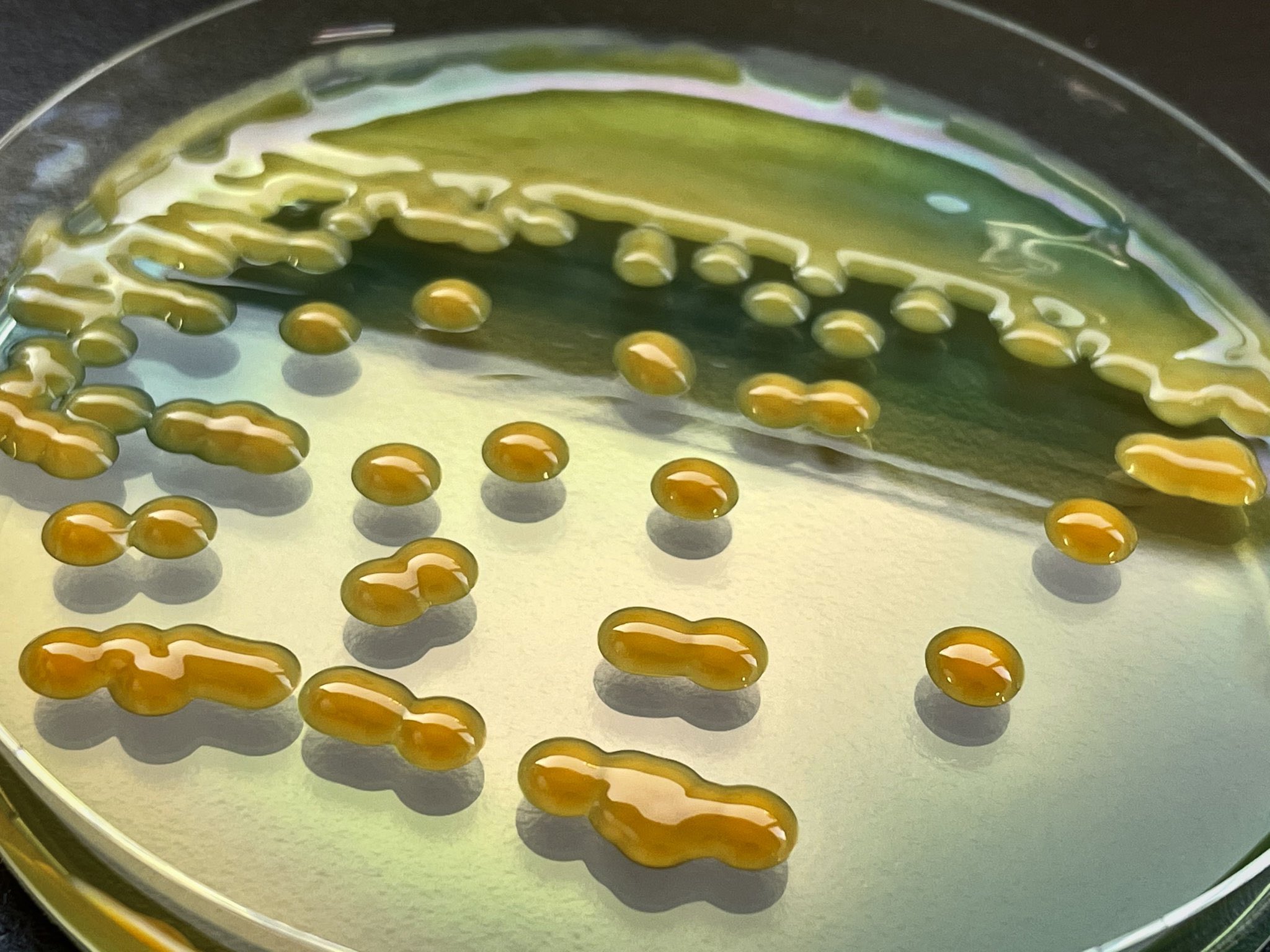 Klebsiella Pneumoniae On Cled Agar Pathophysiology Of Multidrug
