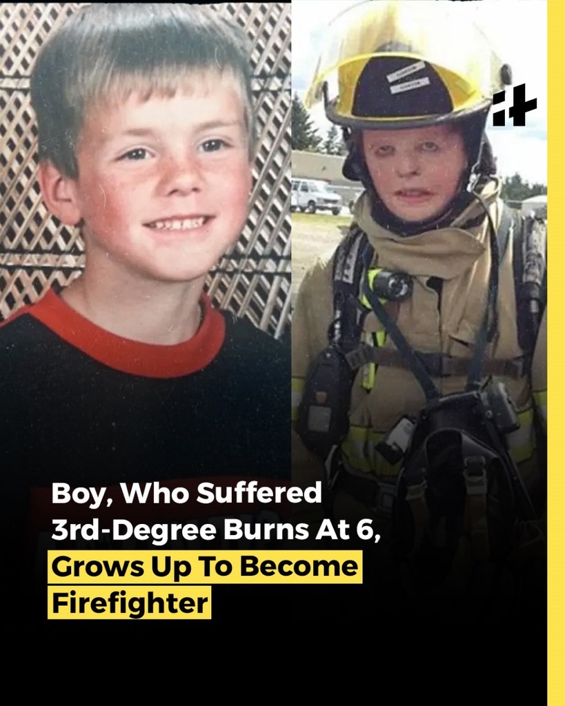 From Tragedy to Triumph: A Survivor’s Journey from Fire to Firefighter ...
