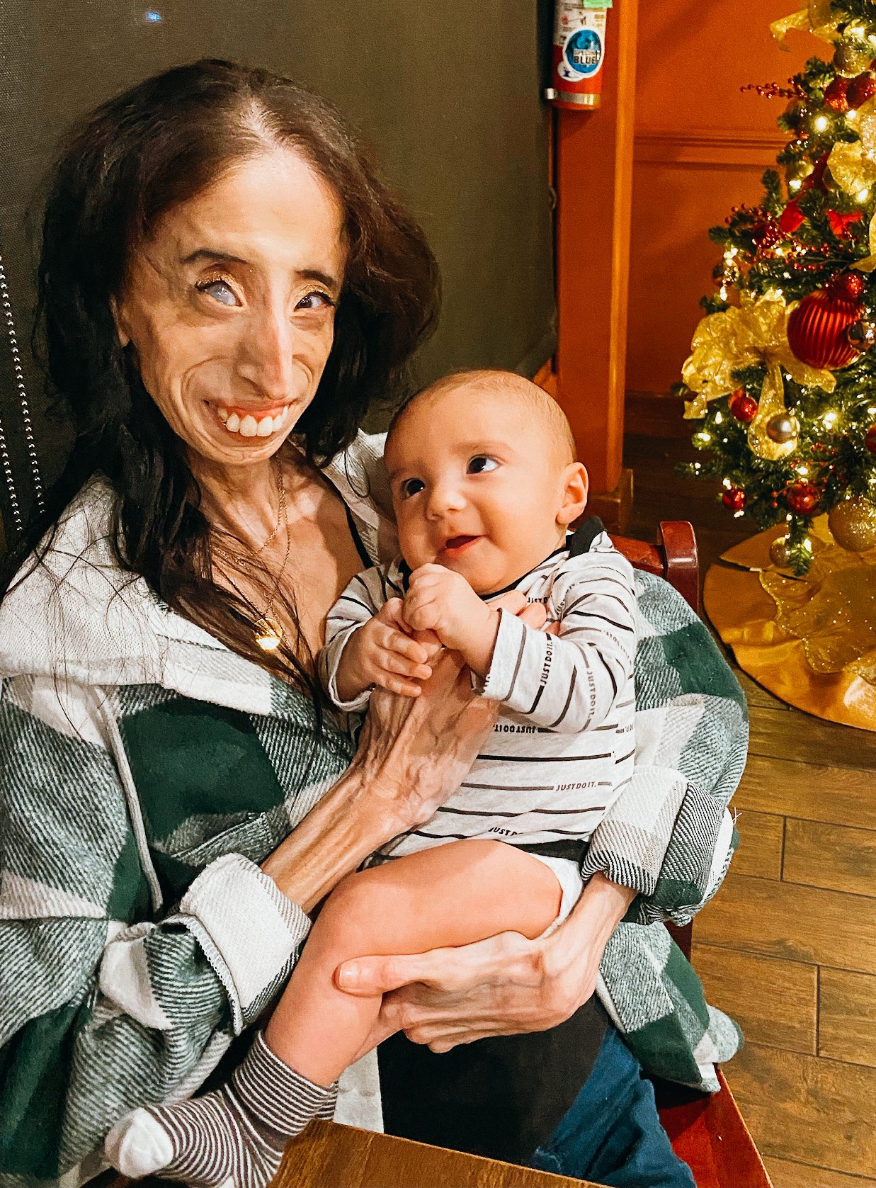 Lizzie Velasquez Eye Lizzie Velasquez Wurde Als "hässlichste Frau Der