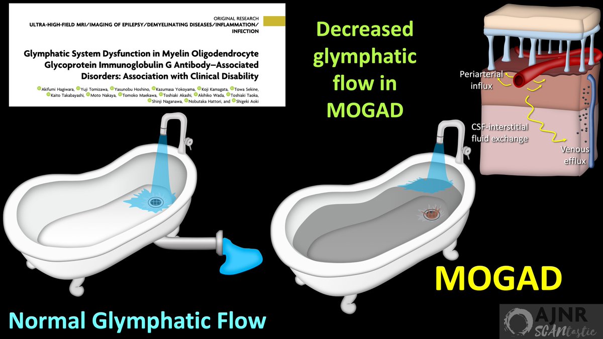 1/Are you in a FOG about MOG? MOG antibody associated disease or MOGAD ...