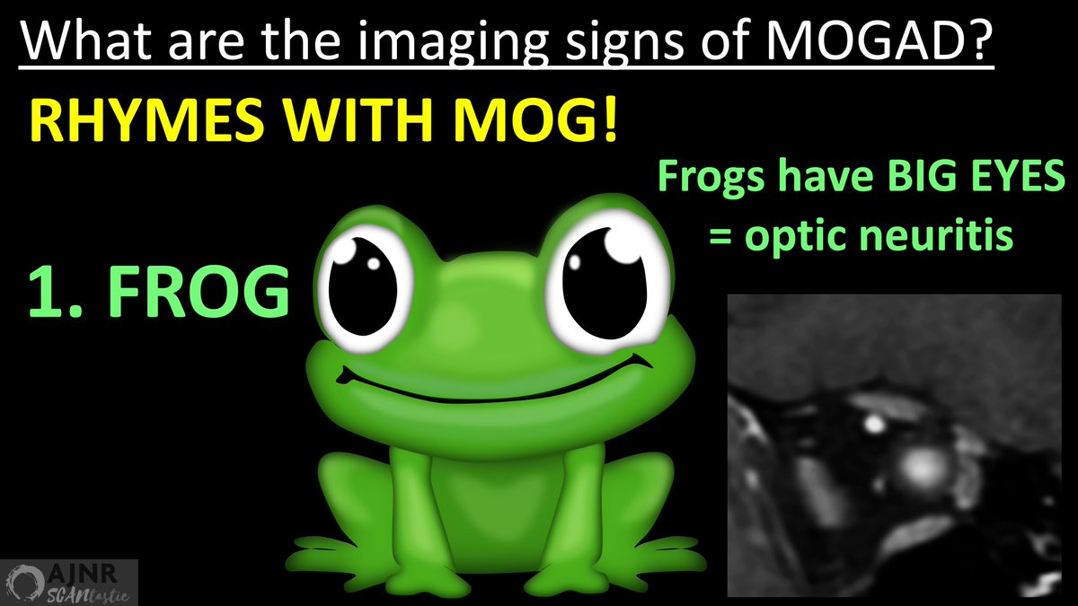 1/Are you in a FOG about MOG? MOG antibody associated disease or MOGAD ...
