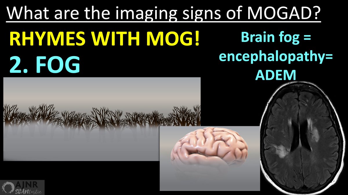 1/Are you in a FOG about MOG? MOG antibody associated disease or MOGAD ...