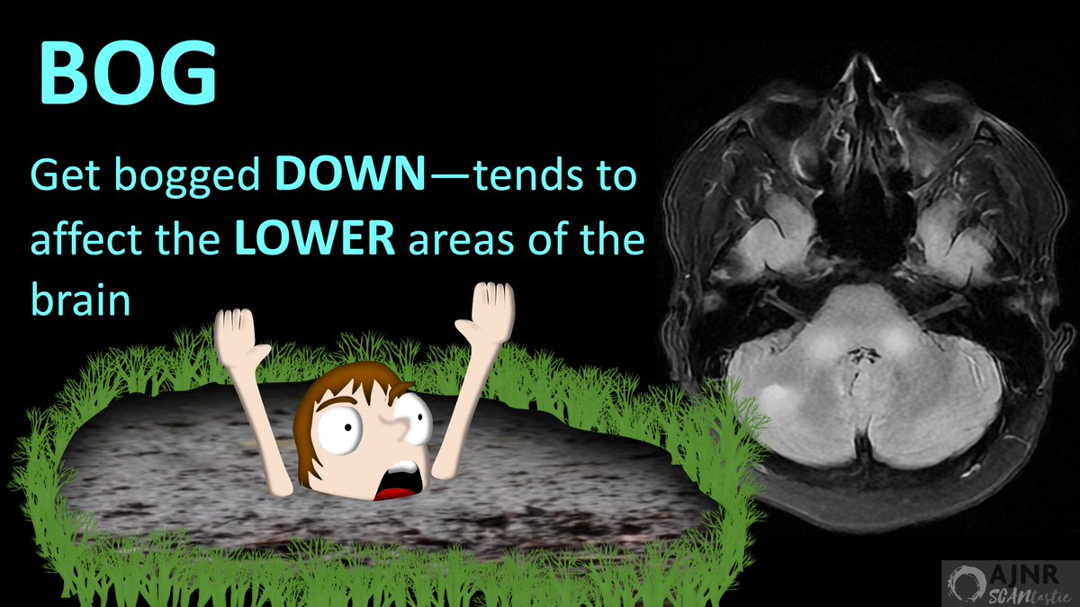 1/Are you in a FOG about MOG? MOG antibody associated disease or MOGAD ...