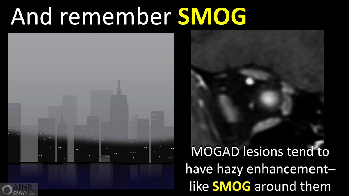 1/Are you in a FOG about MOG? MOG antibody associated disease or MOGAD ...