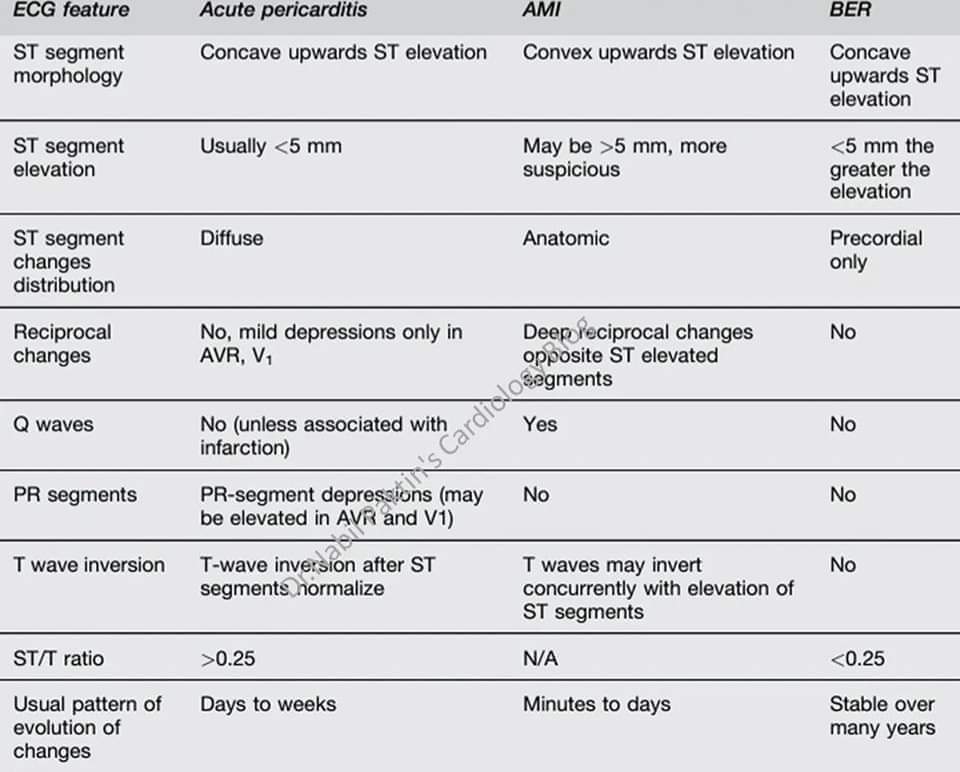 Ecg Difference Between Mi And Pericarditis