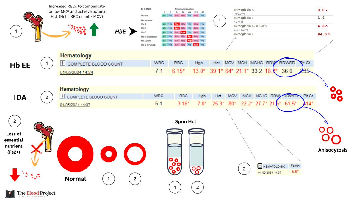 1/2 CASES I tweeted two CBCs from today's clinic asking for the ...