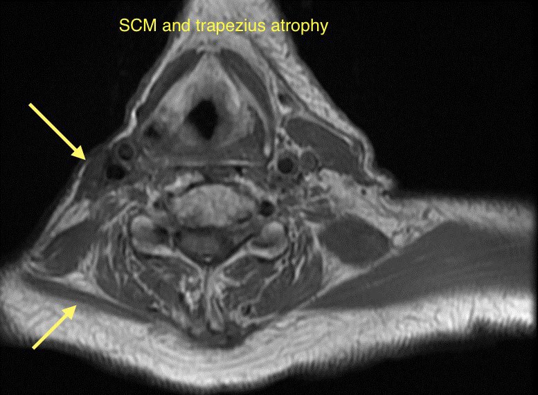 Imaging Quick Tips & Tricks for Cranial Neuropathies 🧠 A neuroimaging 🧵 ...