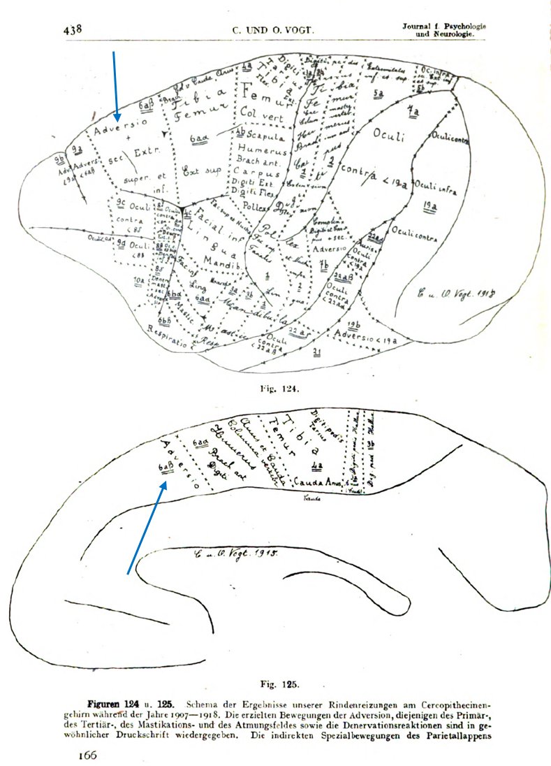 SEIZURE SEMIOLOGY #TWEETORIAL #Epilepsy #Seizure #NeuroX 🧵1. What is ...