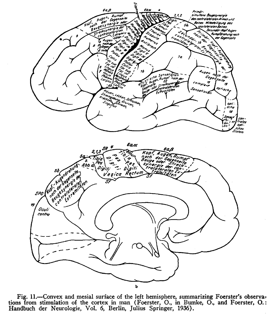 SEIZURE SEMIOLOGY #TWEETORIAL #Epilepsy #Seizure #NeuroX 🧵1. What is ...