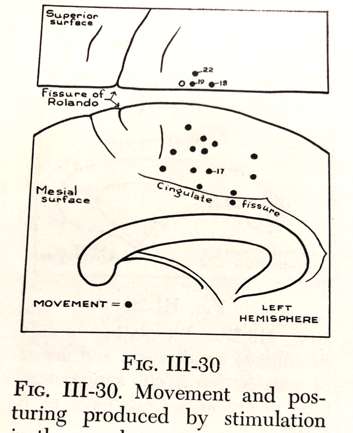 SEIZURE SEMIOLOGY #TWEETORIAL #Epilepsy #Seizure #NeuroX 🧵1. What is ...