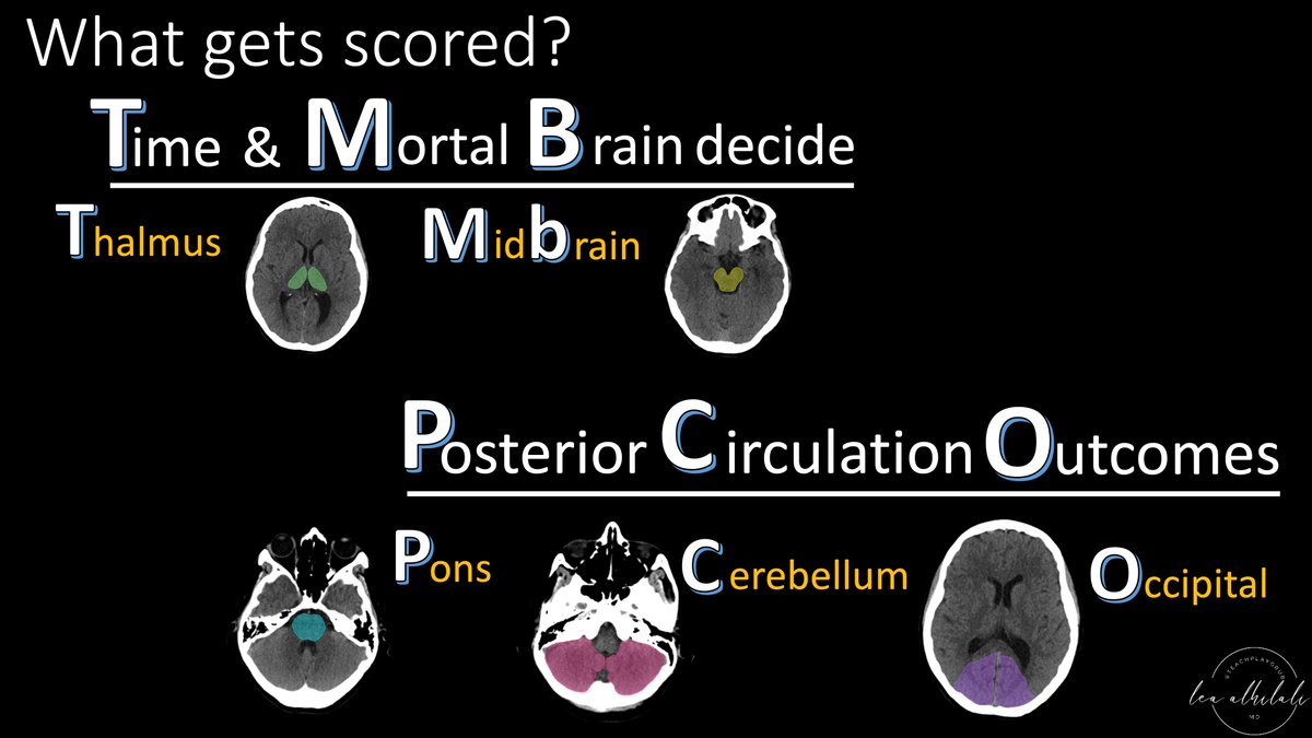 1/Do you know all the aspects of, well, ASPECTS? Many know the anterior ...