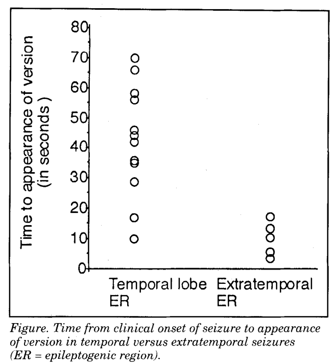 SEIZURE SEMIOLOGY #TWEETORIAL #Epilepsy #Seizure #NeuroX 🧵1. What is ...