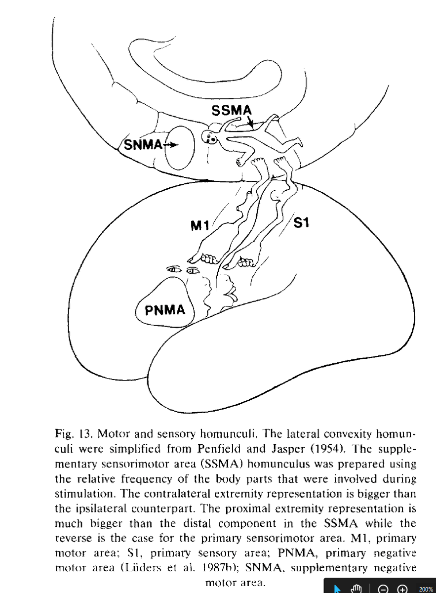 SEIZURE SEMIOLOGY #TWEETORIAL #Epilepsy #Seizure #NeuroX 🧵1. What is ...