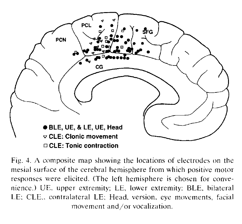 SEIZURE SEMIOLOGY #TWEETORIAL #Epilepsy #Seizure #NeuroX 🧵1. What is ...