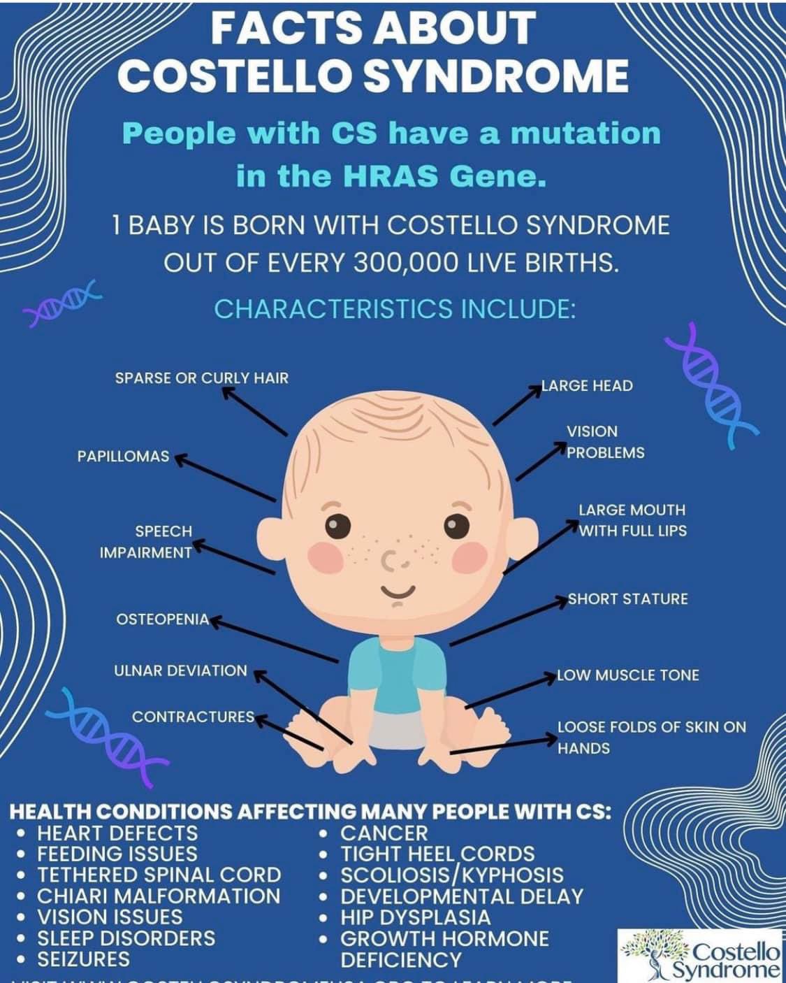 Costello Syndrome About Costello Syndrome
