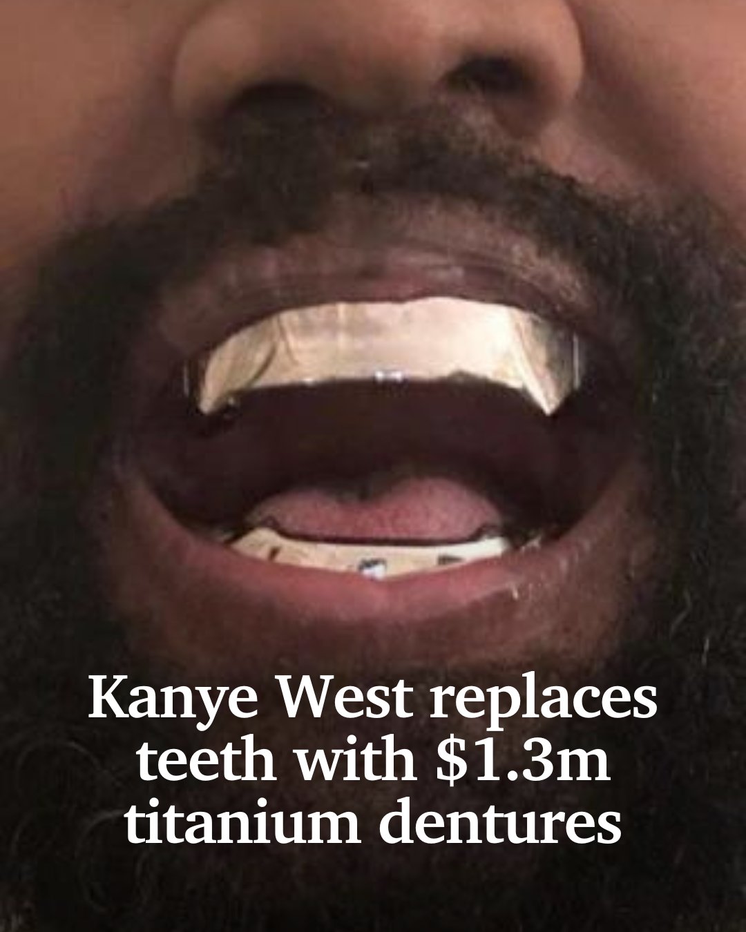 Kanye West No Teeth
