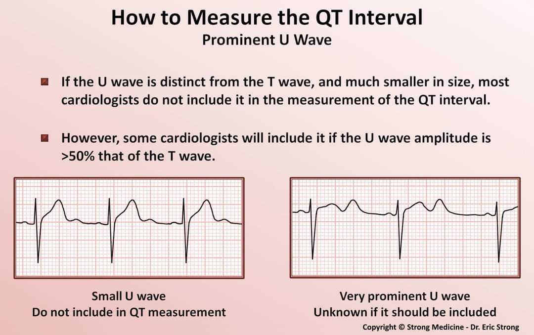 Thread by @ZHeart11768530 on Thread Reader App – Thread Reader App