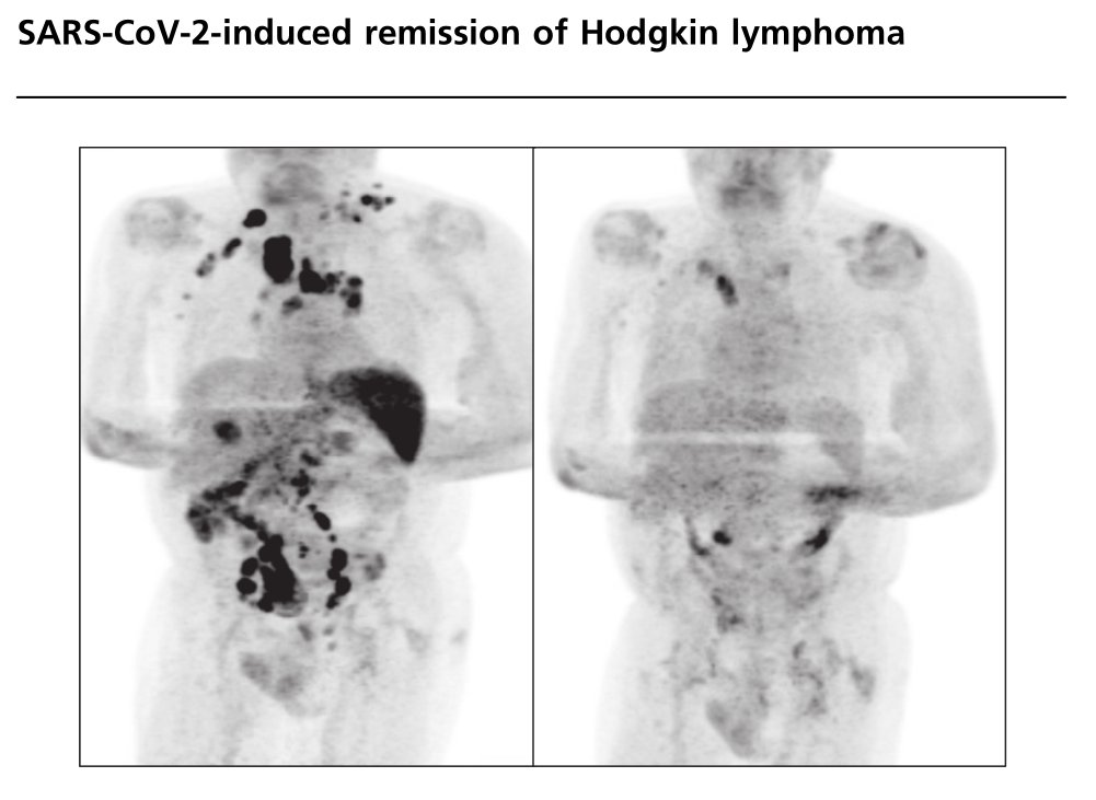 🌼🙂🍊 Peat Pillman's Threads – Thread Reader App