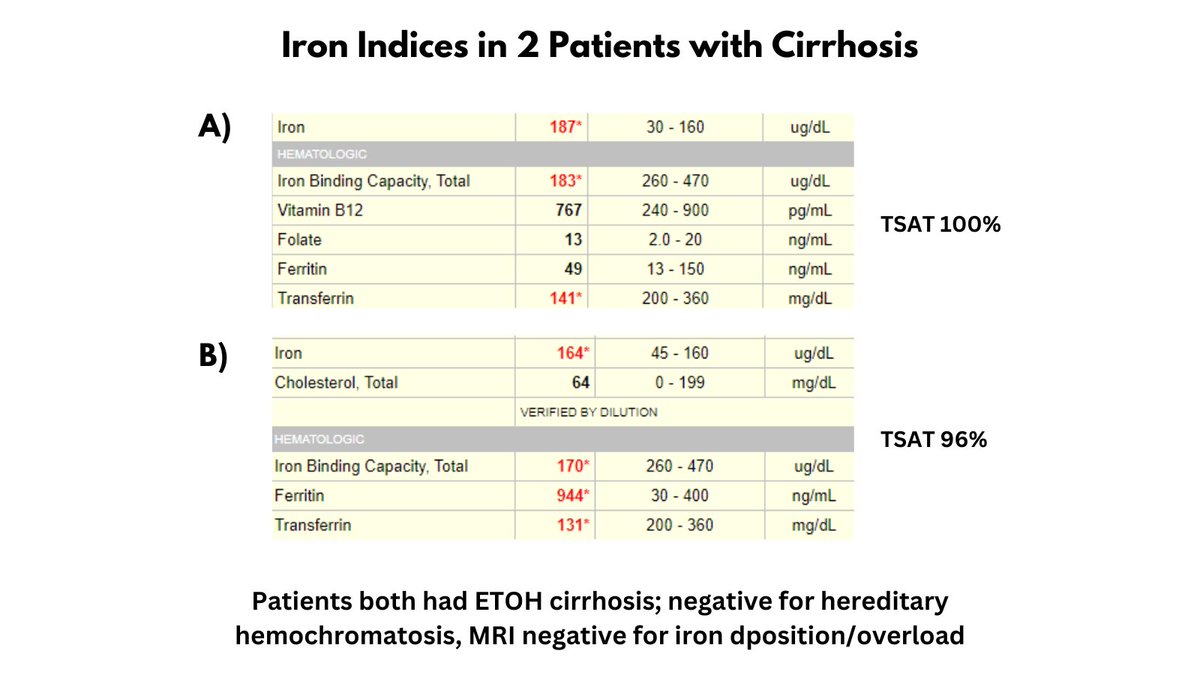 1/2 @ebtapper CIRRHOSIS AND TSAT I keep seeing patients with cirrhosis ...