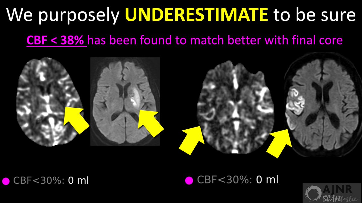 1/Haunted by questions about stroke imaging? Don’t stand a ghost of ...