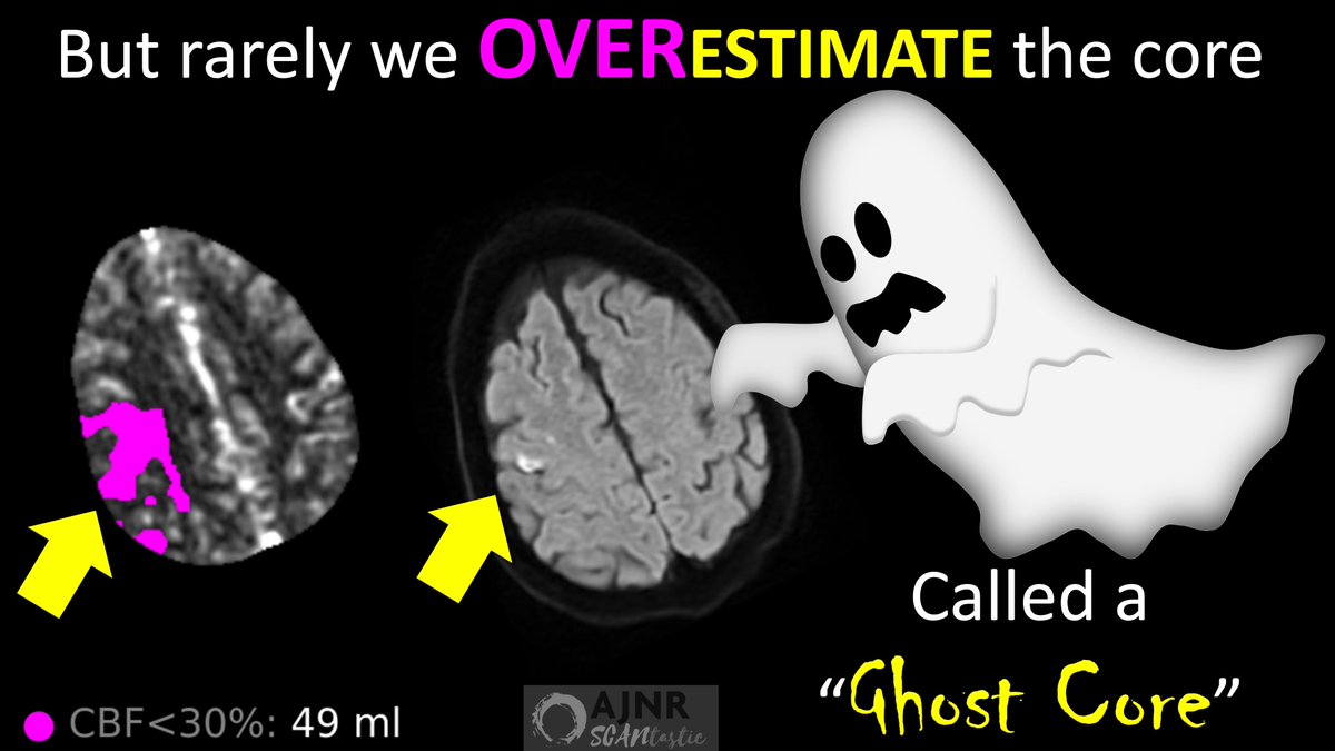 1/Haunted by questions about stroke imaging? Don’t stand a ghost of ...