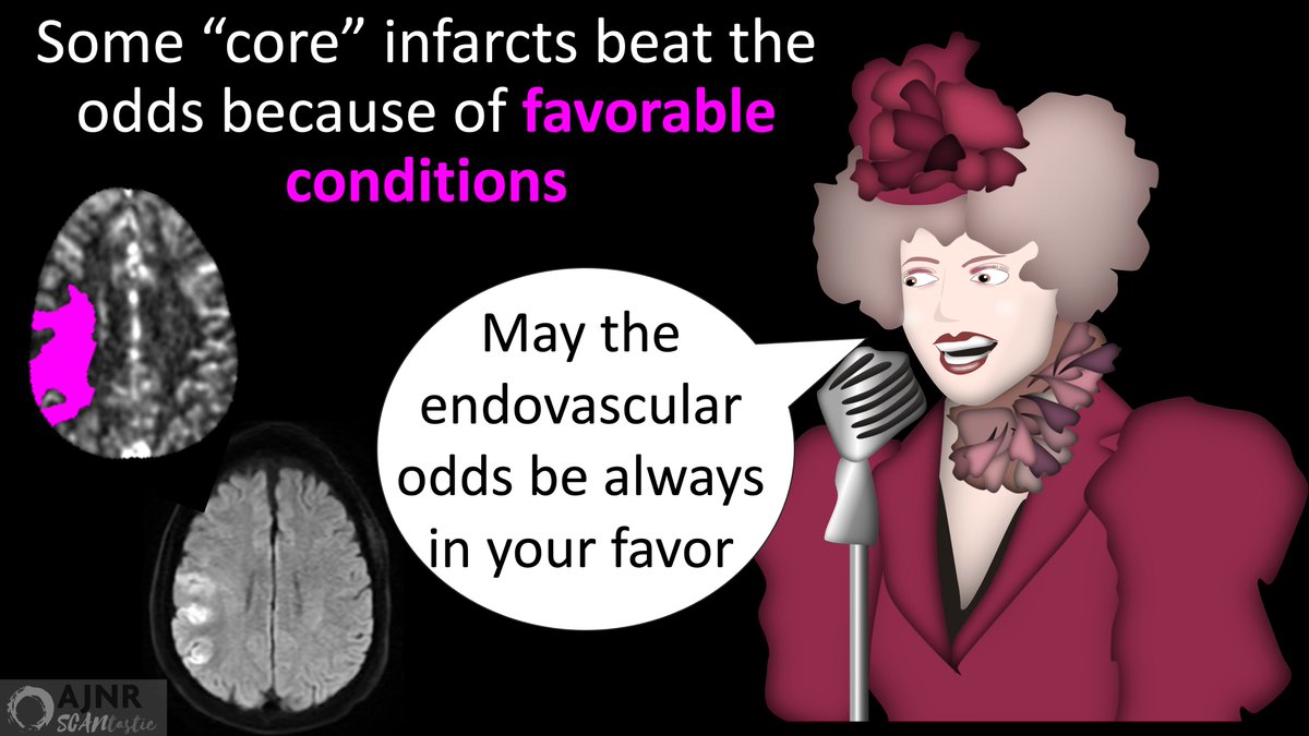 1/Haunted by questions about stroke imaging? Don’t stand a ghost of ...