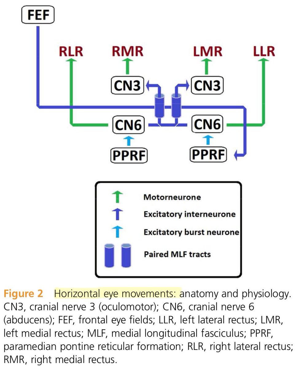 🚨🧠La ⭐️𝗼𝗳𝘁𝗮𝗹𝗺𝗼𝗽𝗹𝗲𝗷𝗶𝗮 𝗶𝗻𝘁𝗲𝗿𝗻𝘂𝗰𝗹𝗲𝗮𝗿 (𝘐𝘕𝘖)⭐️ es resultado de la lesión💥 ...