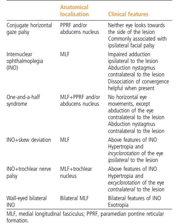 🚨🧠La ⭐️𝗼𝗳𝘁𝗮𝗹𝗺𝗼𝗽𝗹𝗲𝗷𝗶𝗮 𝗶𝗻𝘁𝗲𝗿𝗻𝘂𝗰𝗹𝗲𝗮𝗿 (𝘐𝘕𝘖)⭐️ es resultado de la lesión💥 ...