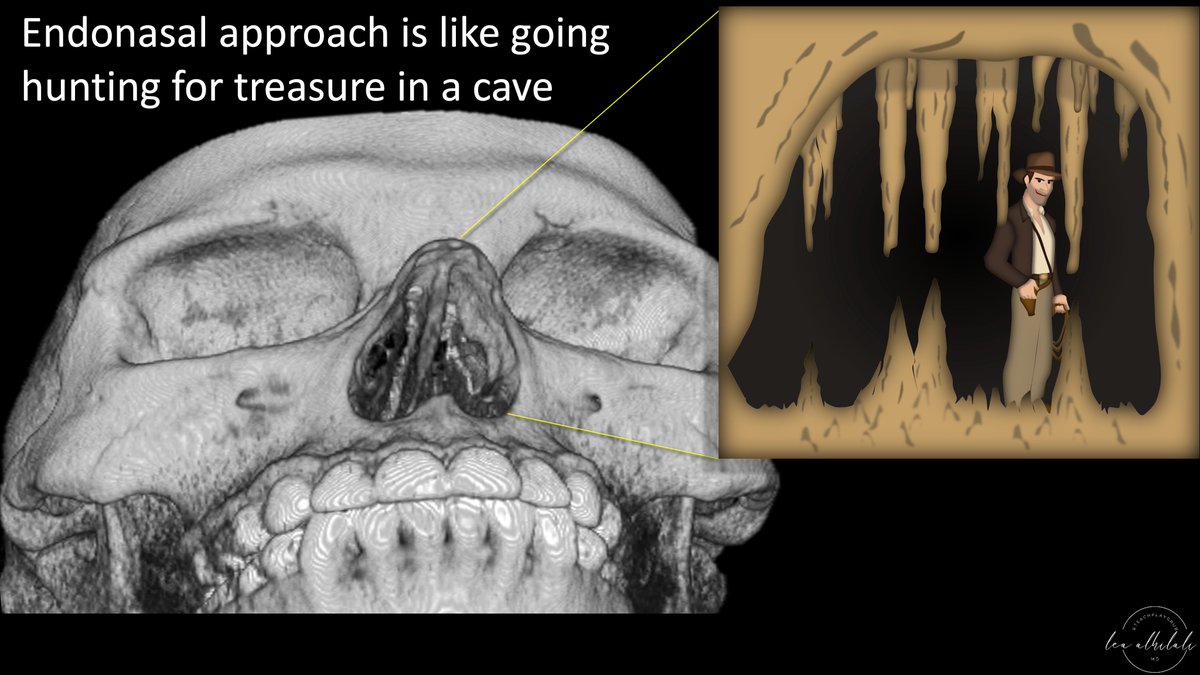 1/Want to understand skull base surgery? Just follow your nose ...