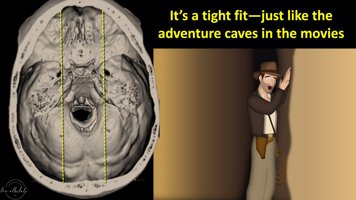 1/Want to understand skull base surgery? Just follow your nose ...