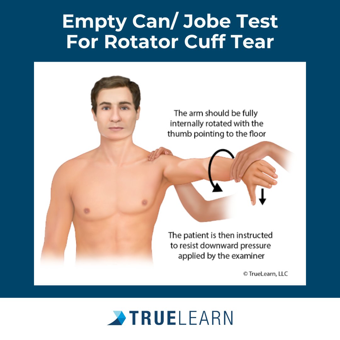 Jobe Test Results For MSK PhysicalExam Shoulder Jobe | GrepMed