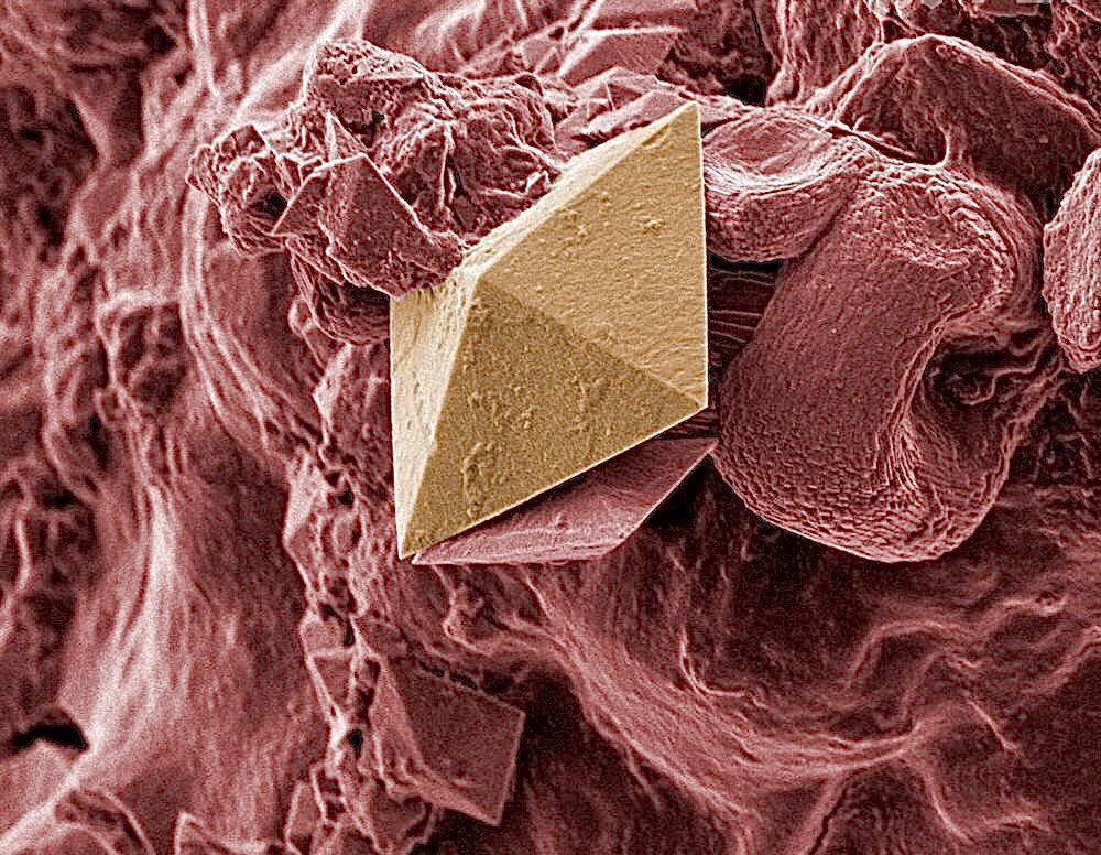 Calcium Oxalate Kidney Stones Microscope Investigation Of Potential
