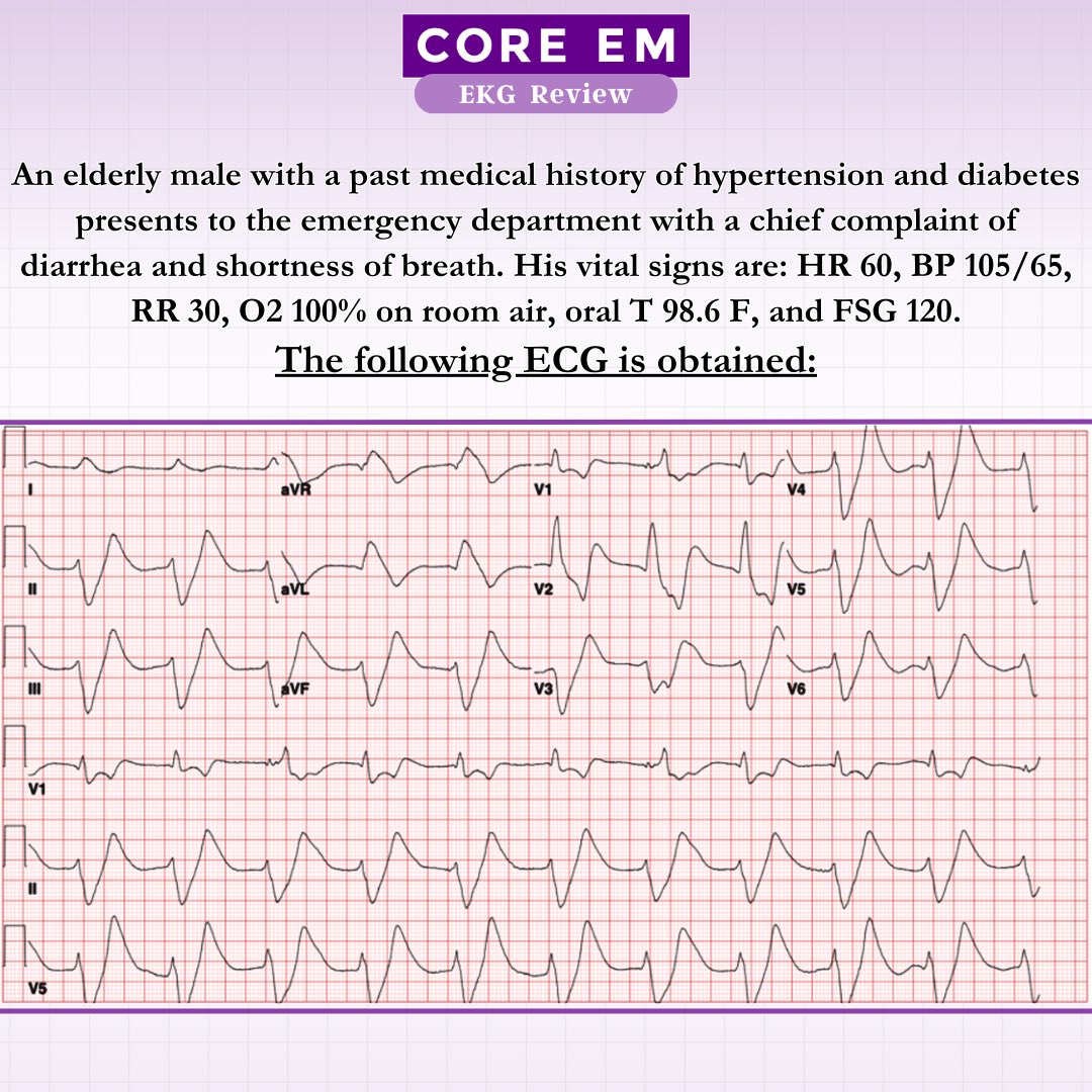 You see this EKG, which two medications are you considering giving ...