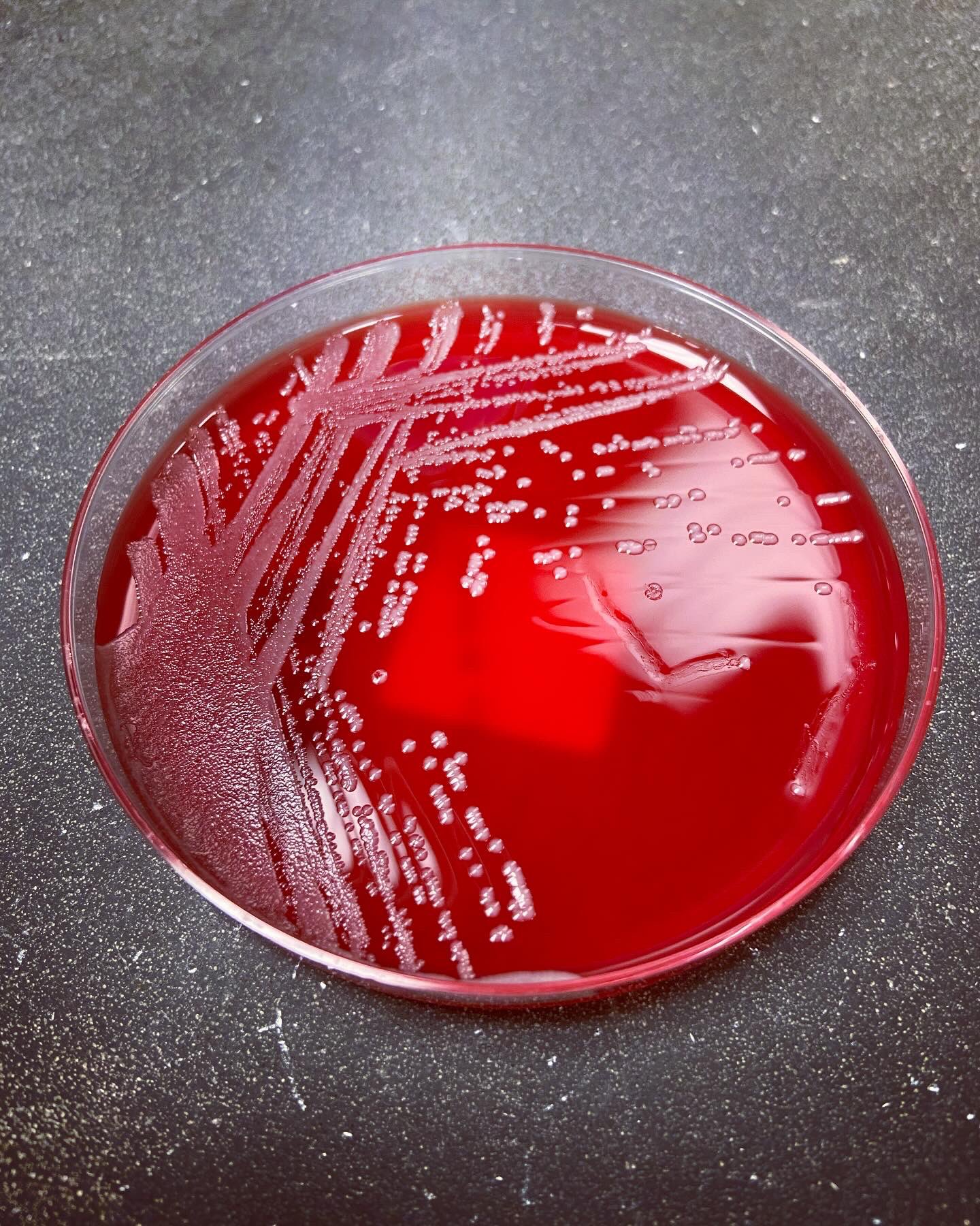 Moraxella Blood Agar Plate Microbiologic And Virulence Characteristics