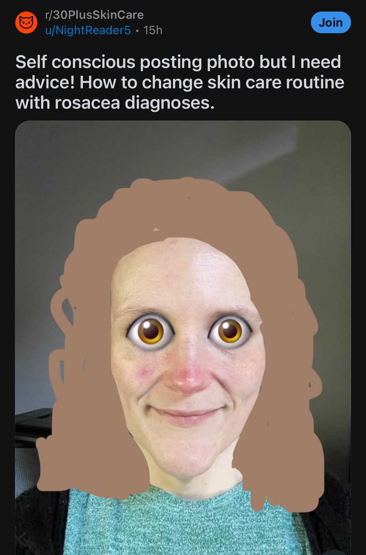 Rosacea Memes