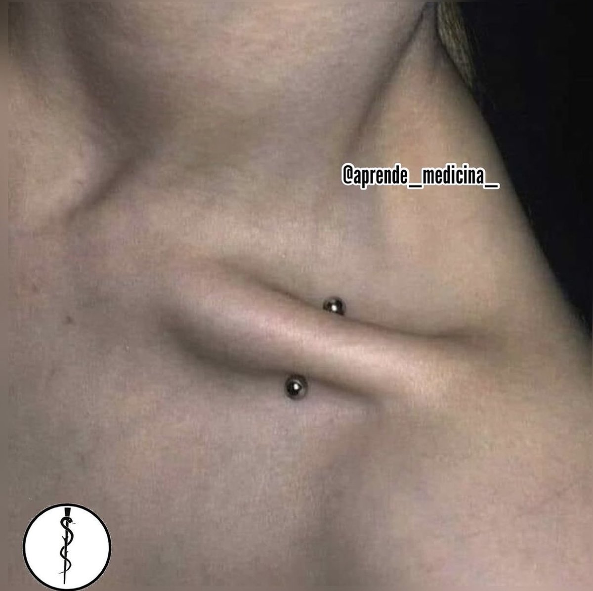 Vicki Cherry on X I m 99 sure this is fake. I ve only ever seen this exact photo of this piercing never any other angles or times. No evidence of healing recent piercing too