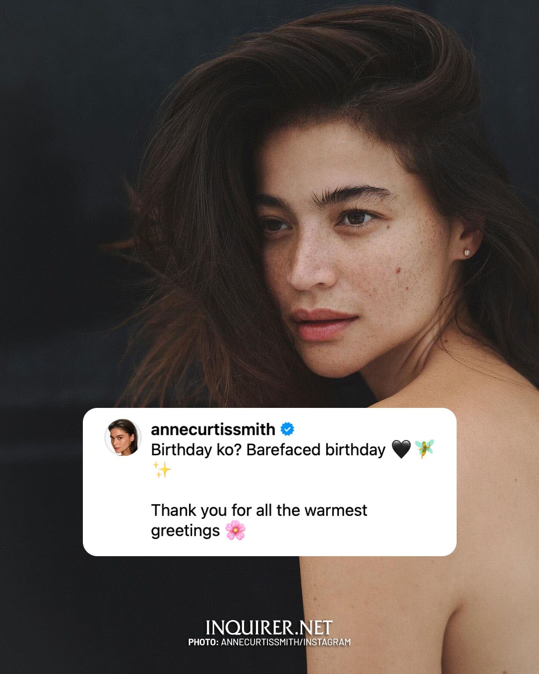 Anne Curtis Instagram