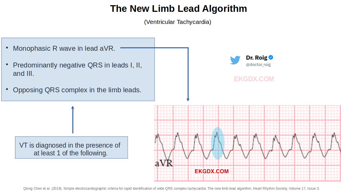 1/ Today's 🧵is about "VT" versus "SVT with aberrancy". The aim of this ...