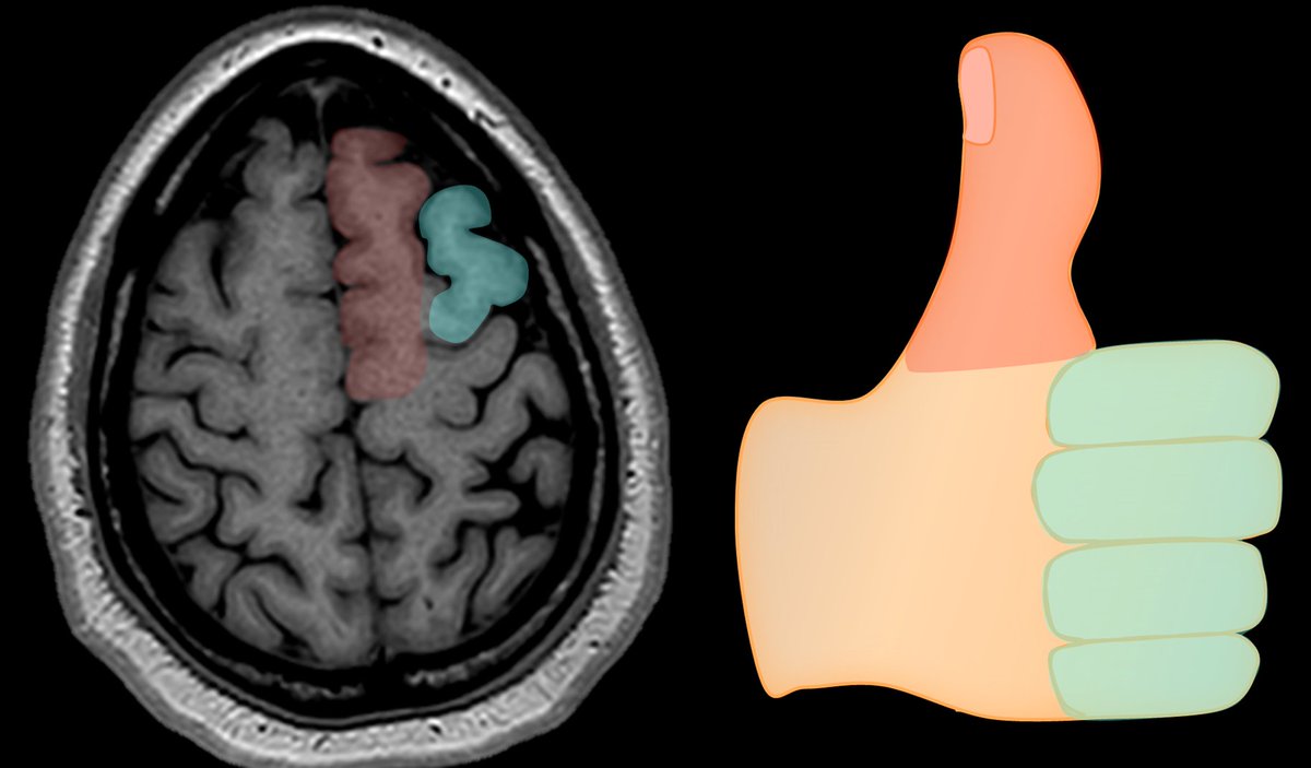 1/They say form follows function! Brain MRI anatomy is best understood ...