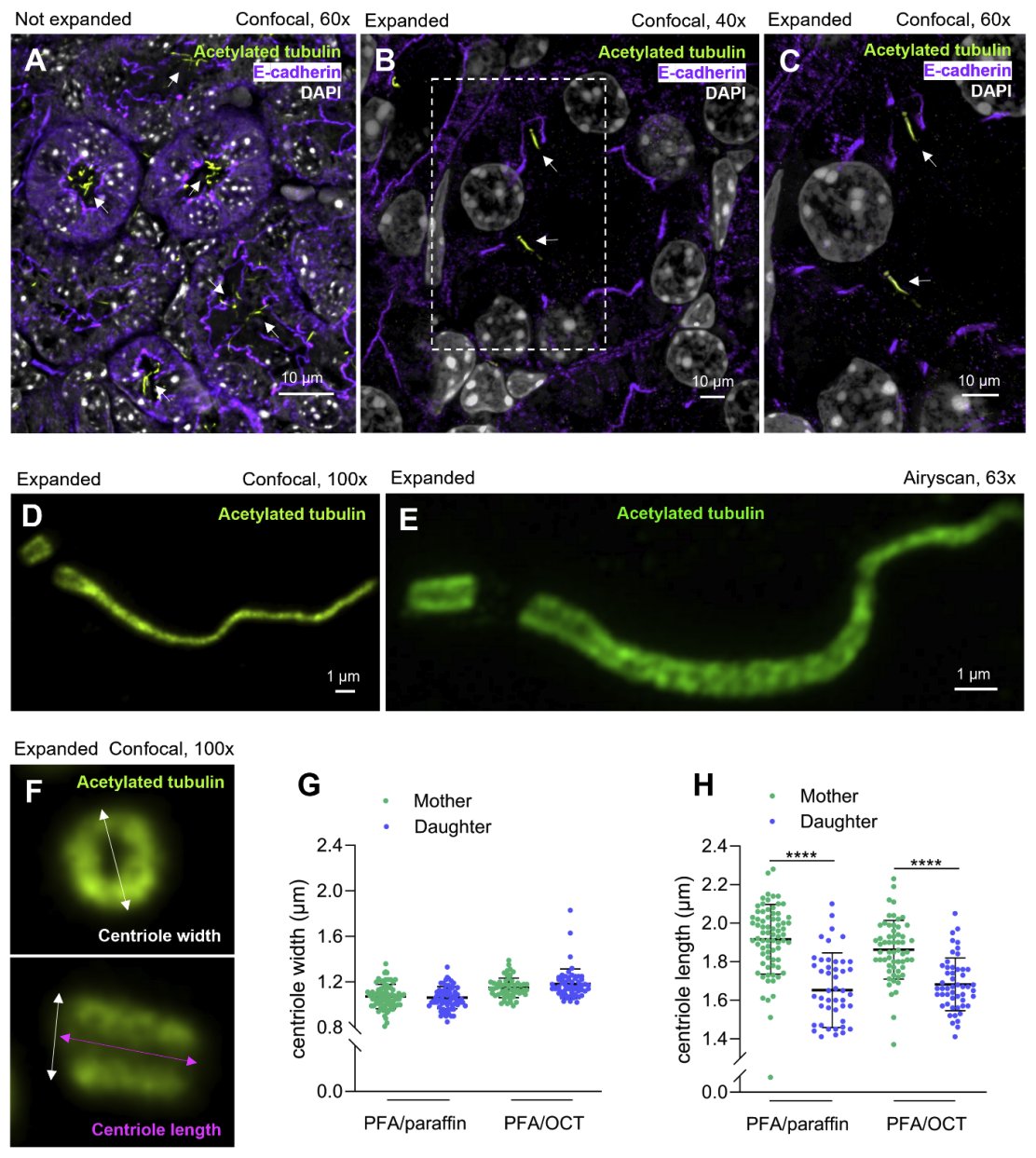 Ultrastructure Platelet Transmission Electron Microscopy For The