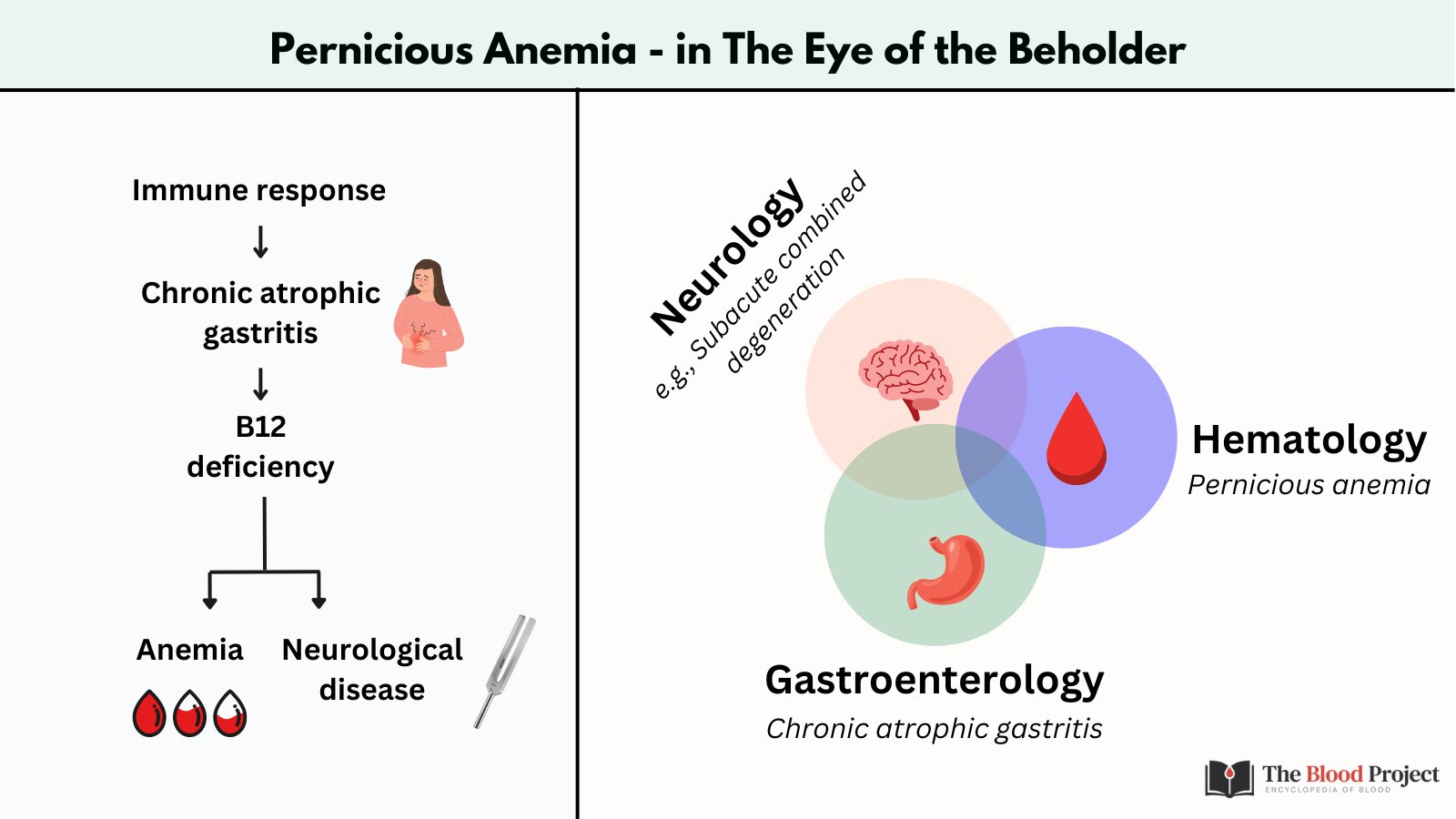 Pernicious Anemia Pernicious Anemia: A Beginner's 5 Step Guide On