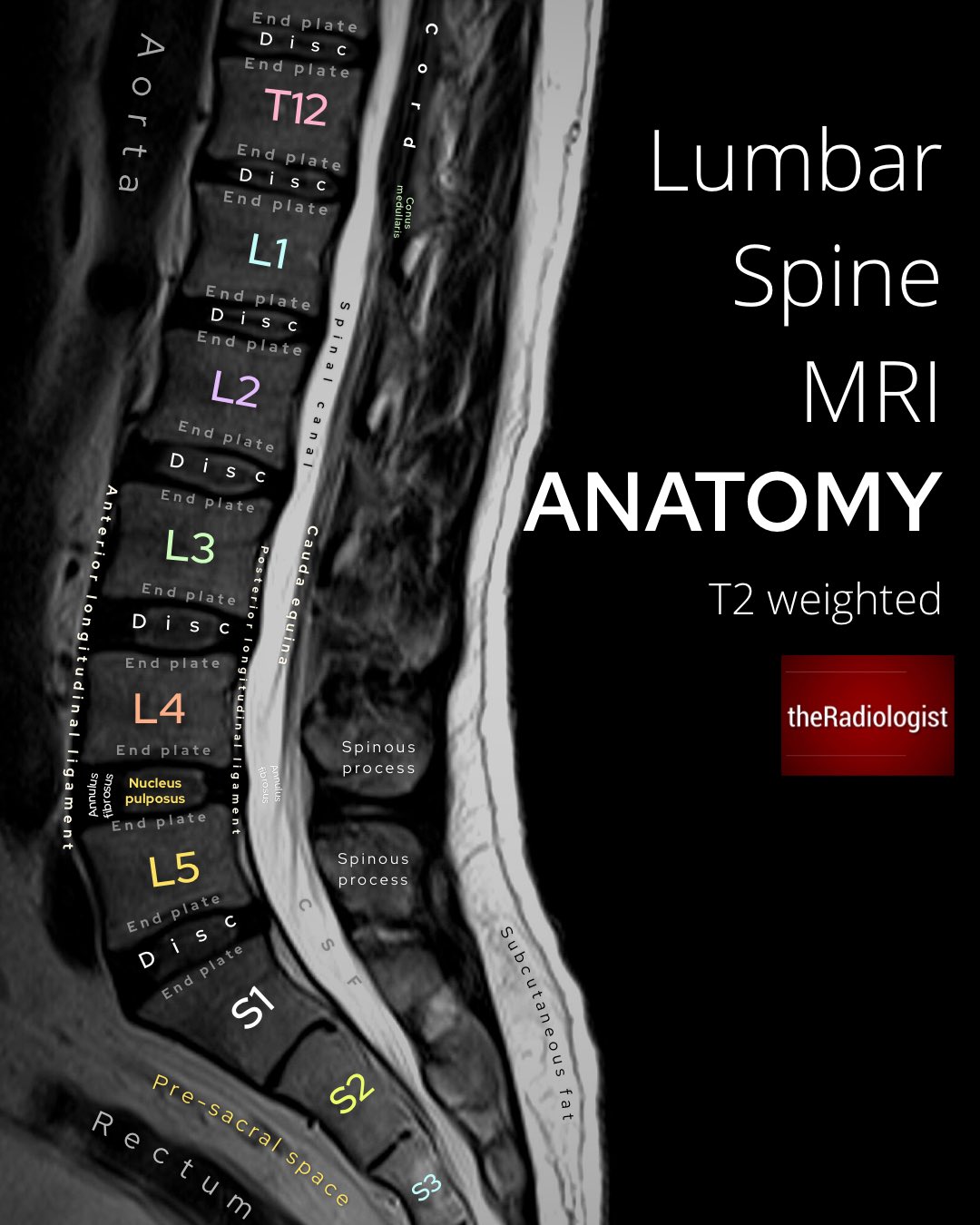 Lumbar Spine Anatomy Mri Lumbar Spine MRI | Quantitative