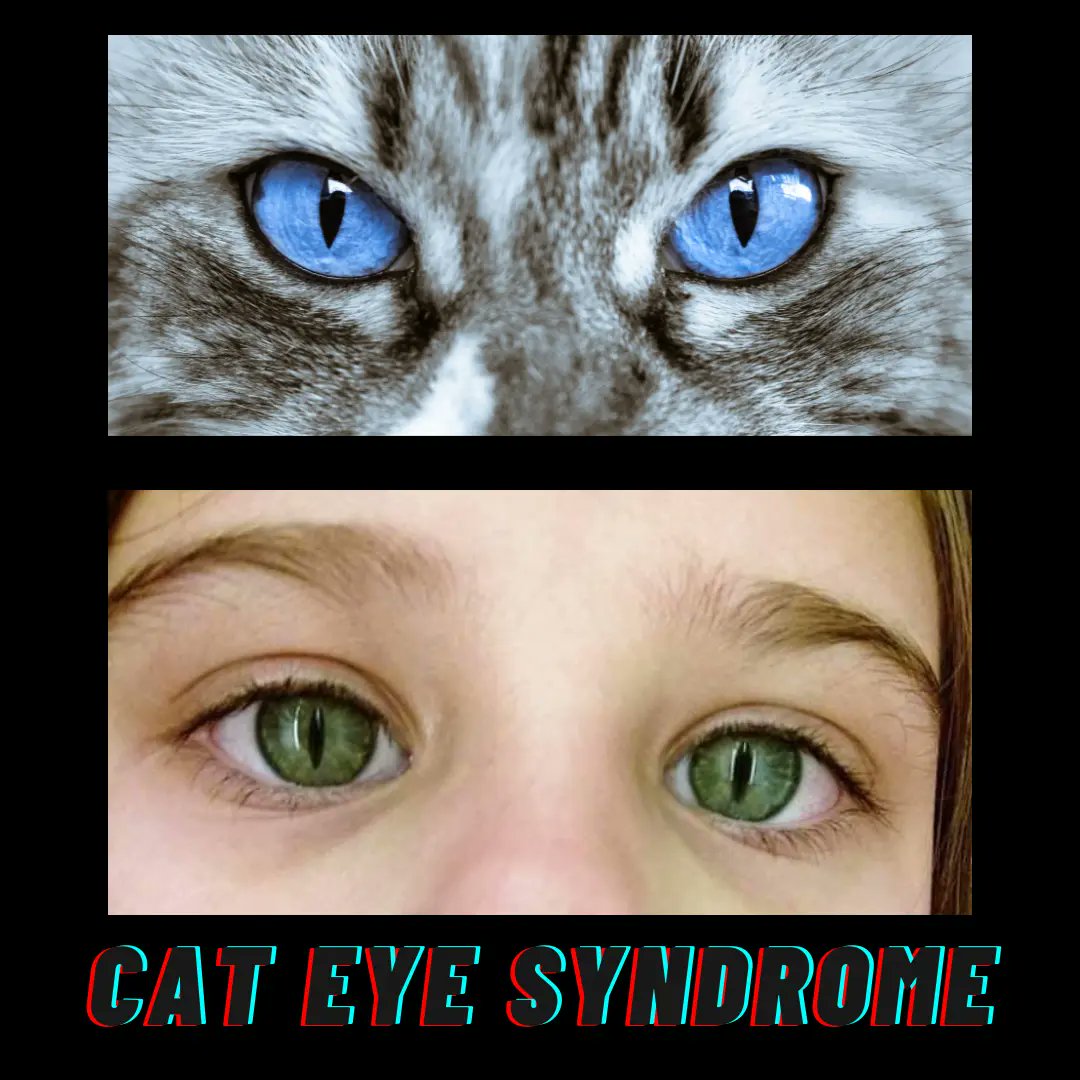 Human With Cat Pupils