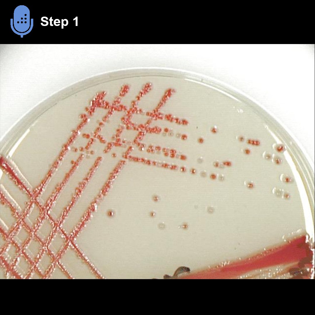Serratia Marcescens Nutrient Agar
