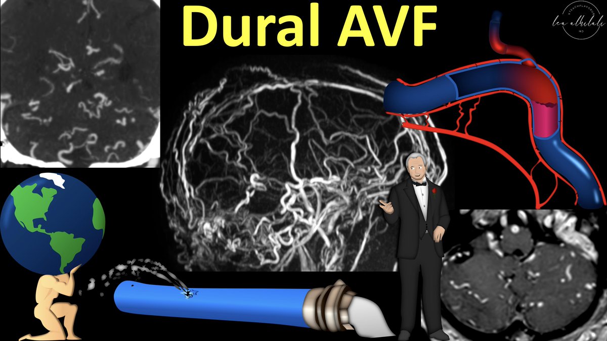 Thread by @teachplaygrub on Thread Reader App – Thread Reader App