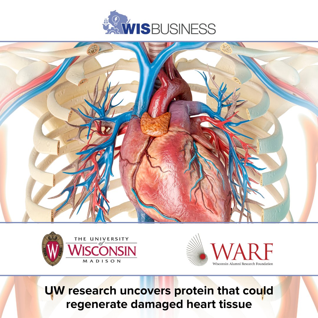 UW-Madison’s single biggest major is Comp Sci: Learn why that matters ...