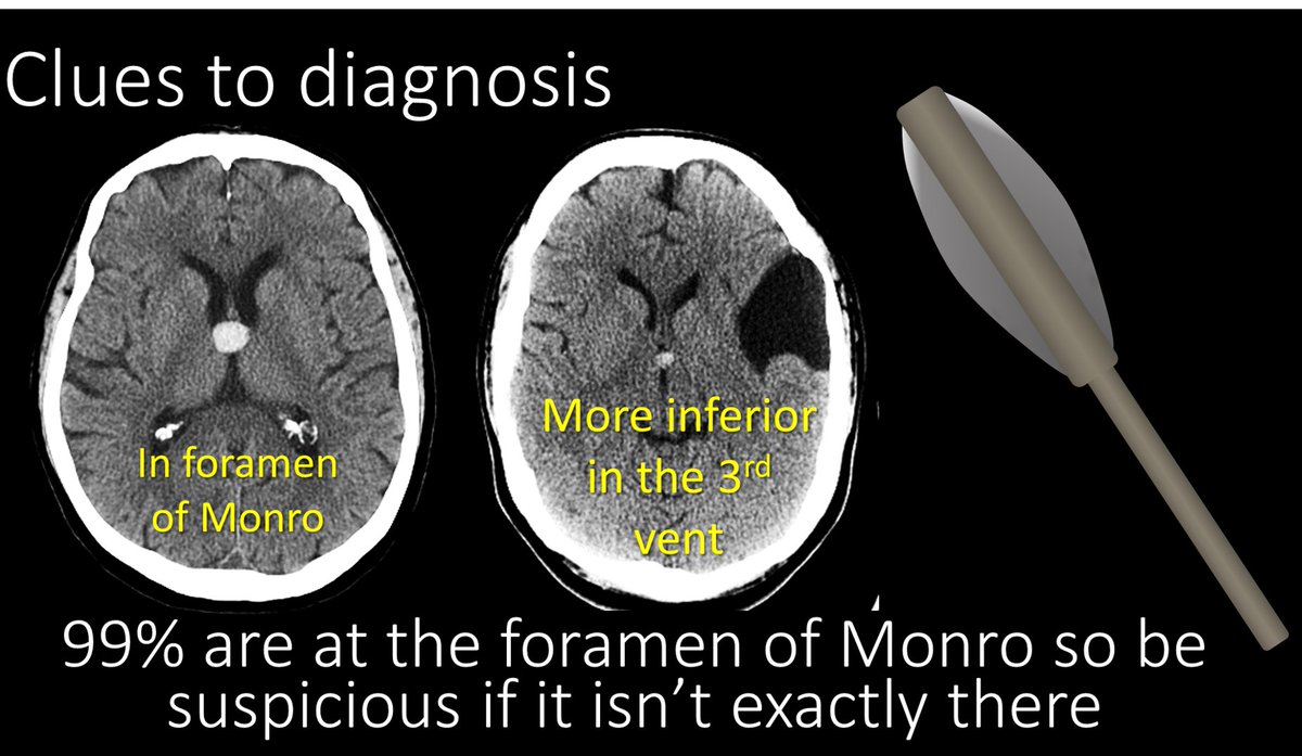 1/Don't fall for the siren song of calling all bright round objects at ...